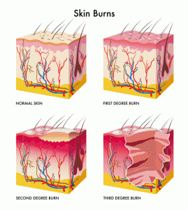 What happens when we get sunburnt? | Science Illustrated