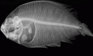X-ray | Science Illustrated